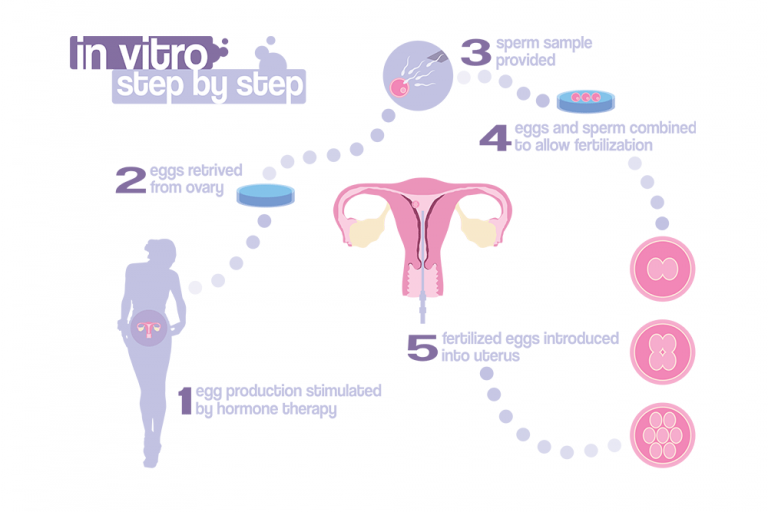 Sve što trebate znati o medicinski potpognutoj oplodnji u 2021.