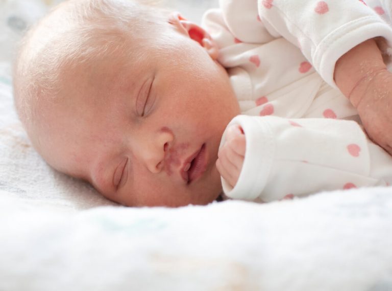 Rodin ugriz kod beba - uzrok, uklanjanje i liječenje